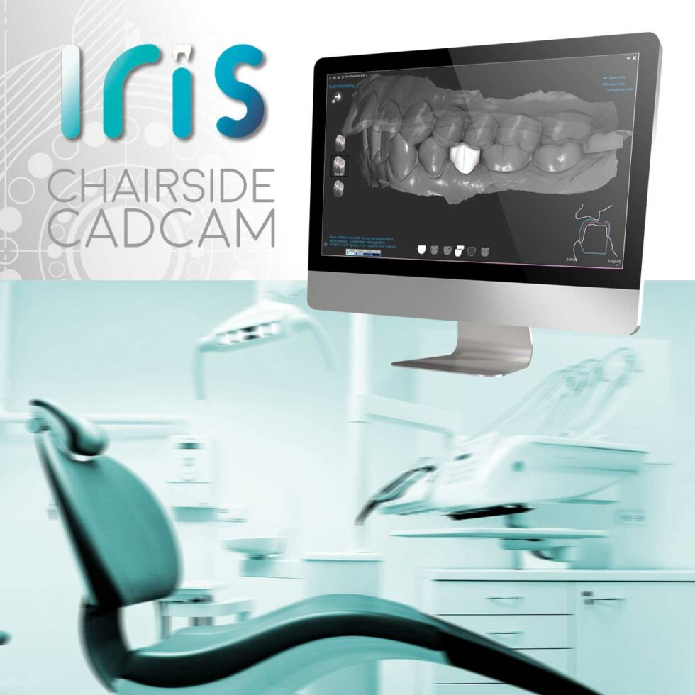 Iris Chairside cad/cam - Design and production of dental crowns